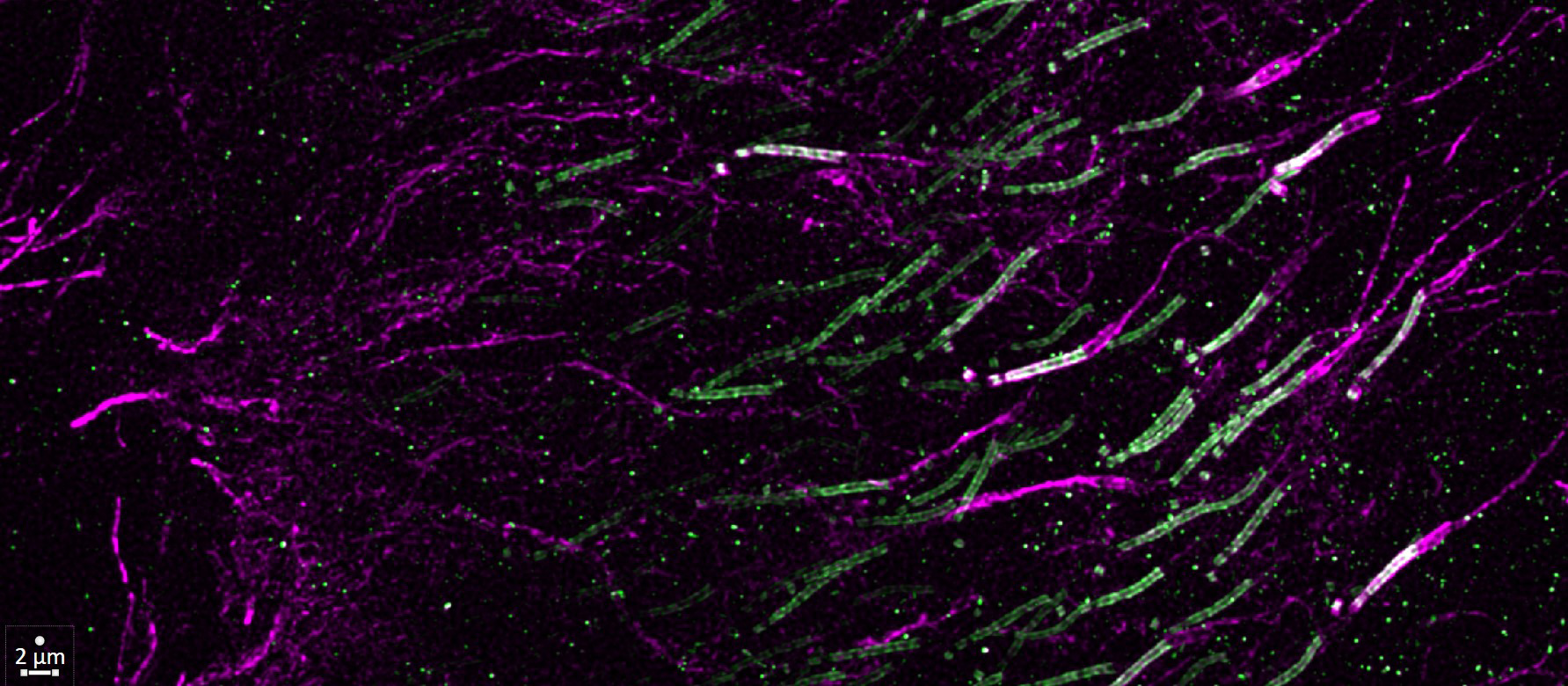 Expansion Microscopy Meeting Geneva